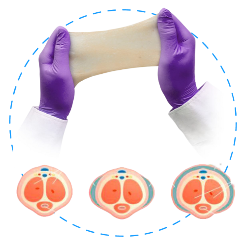 Agrandamiento peneano con técnicas especiales | Úrologo Dr. Uriel Ayala