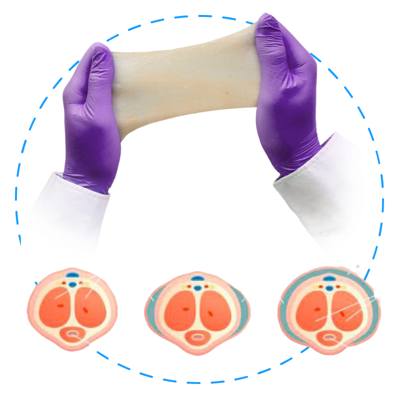 Agrandamiento peneano con técnicas especiales | Úrologo Dr. Uriel Ayala