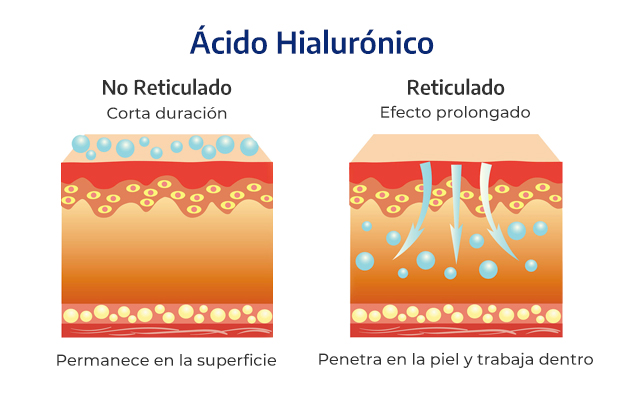 Agrandamiento peneano sin cirugía | Úrologo Dr. Uriel Ayala